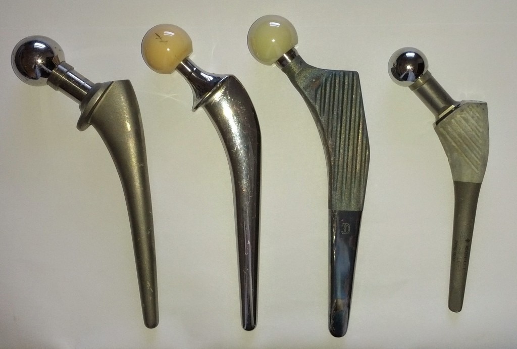 La prothèse de hanche - Docteur Stéphane DIDELOT